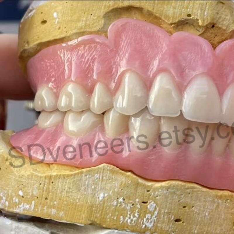 Dentures - Etsy