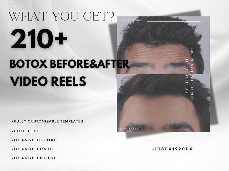 Botox| Botox Before and After | Botox Instagram Posts | Skincare ...