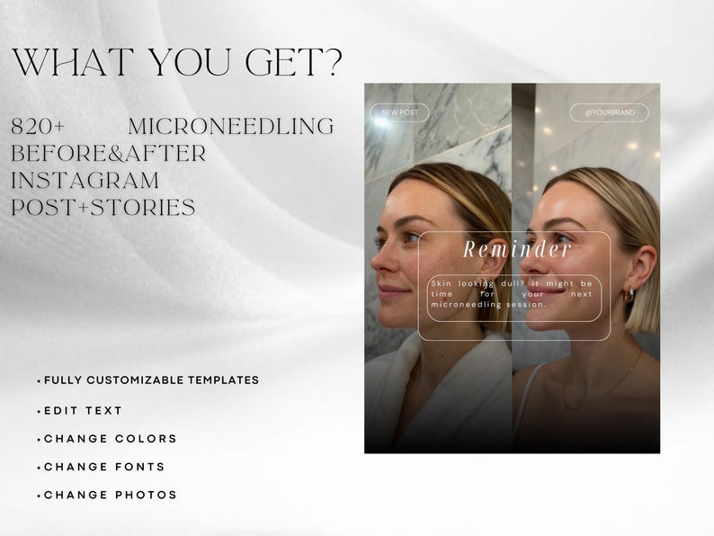 Microneedling Instagram Canva Template: Skincare Before & After Posts ...