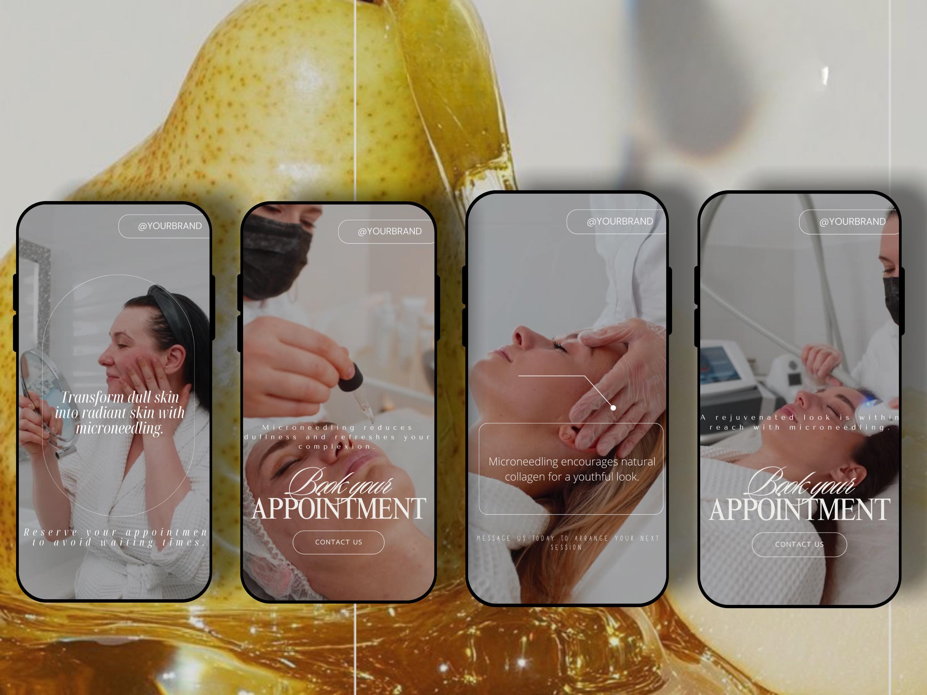 Microneedling Instagram Reels Bundle | RF & Facial Treatment Video ...