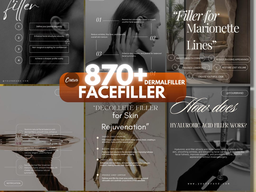 Dermal Filler Instagram Templates | Editable Canva Posts for Medspa ...