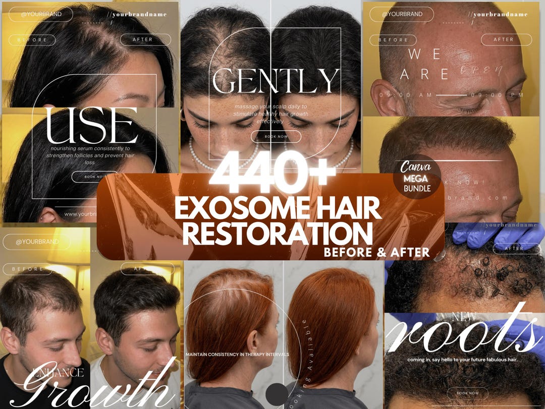 Hair Clinic Canva Template | Before After Post | Medical Spa Social ...