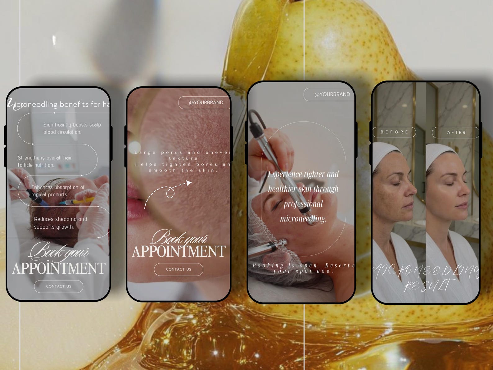Microneedling Instagram Reels Bundle | RF & Facial Treatment Video ...