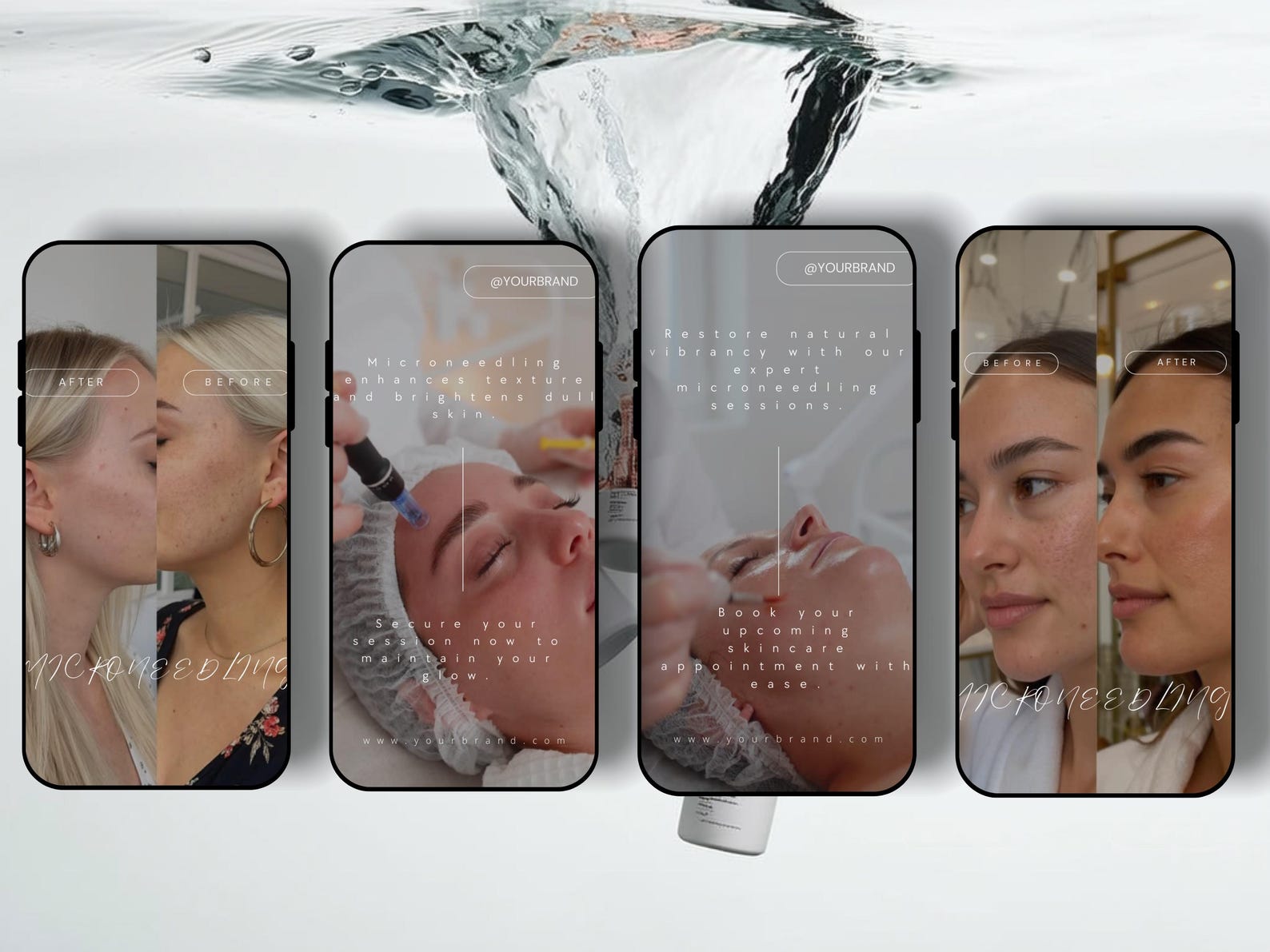 Microneedling Instagram Reels Bundle | RF & Facial Treatment Video ...