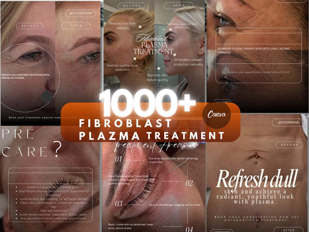Plasma Pen Fibroblast Templates | Clinic Canva Templates | Beauty ...