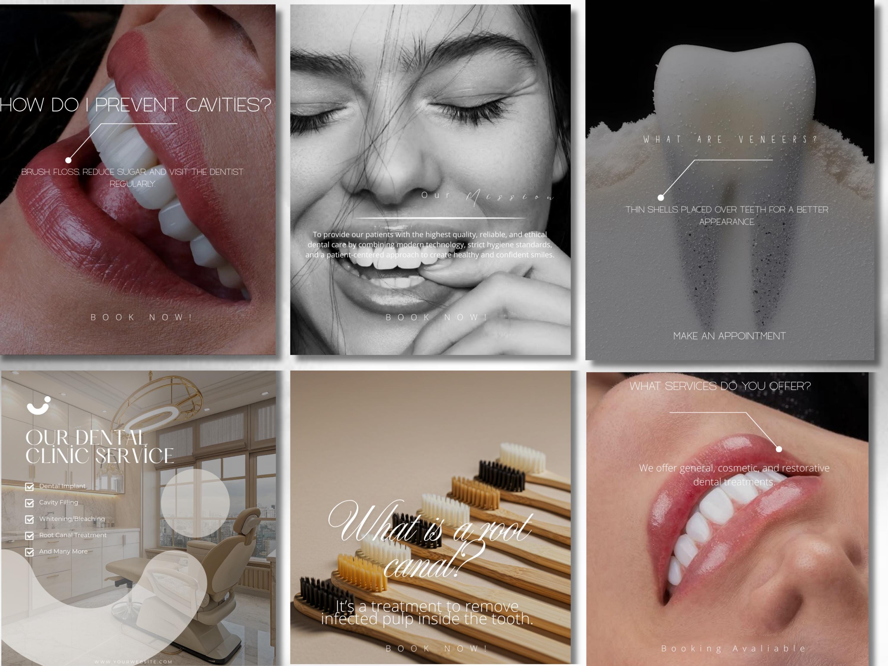 400 Dentist Social Media Kit: 400+ Canva Templates for Instagram ,teeth ...