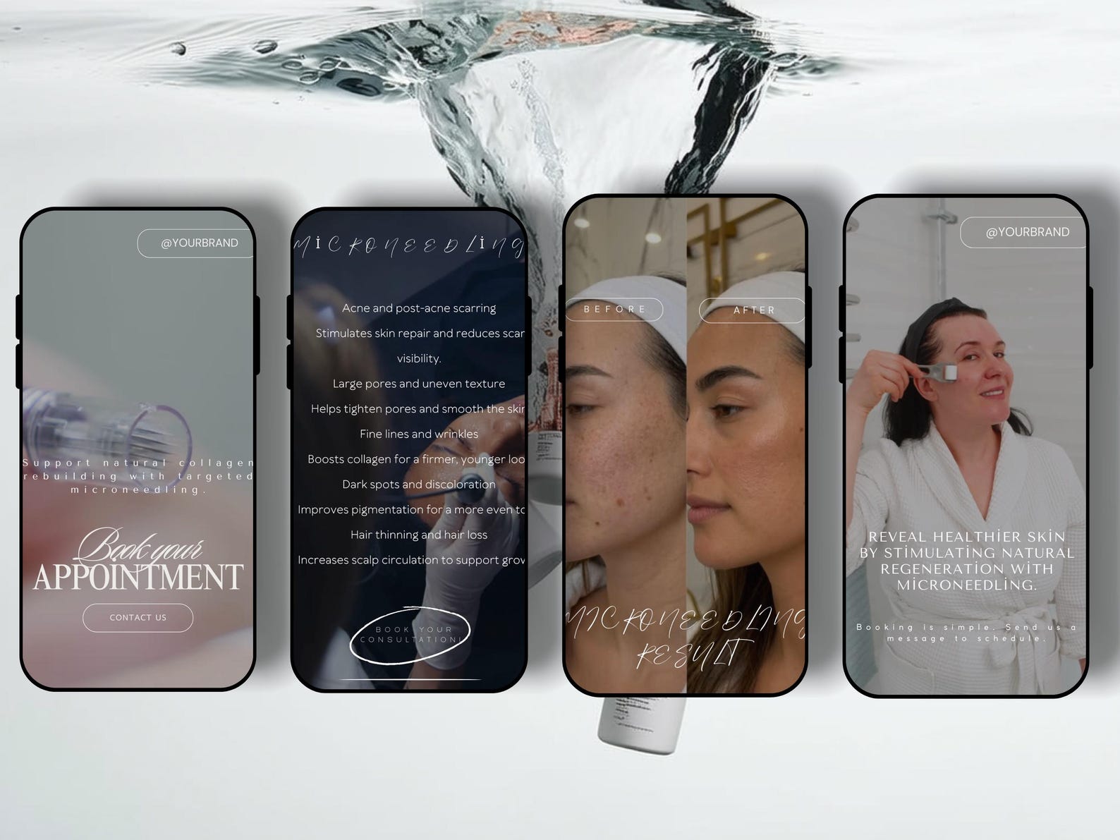 Microneedling Instagram Reels Bundle | RF & Facial Treatment Video ...