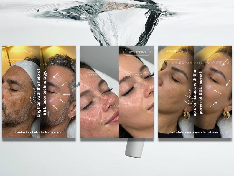 BBL Laser Canva Template, Med Spa Treatment Tracker, Esthetician ...