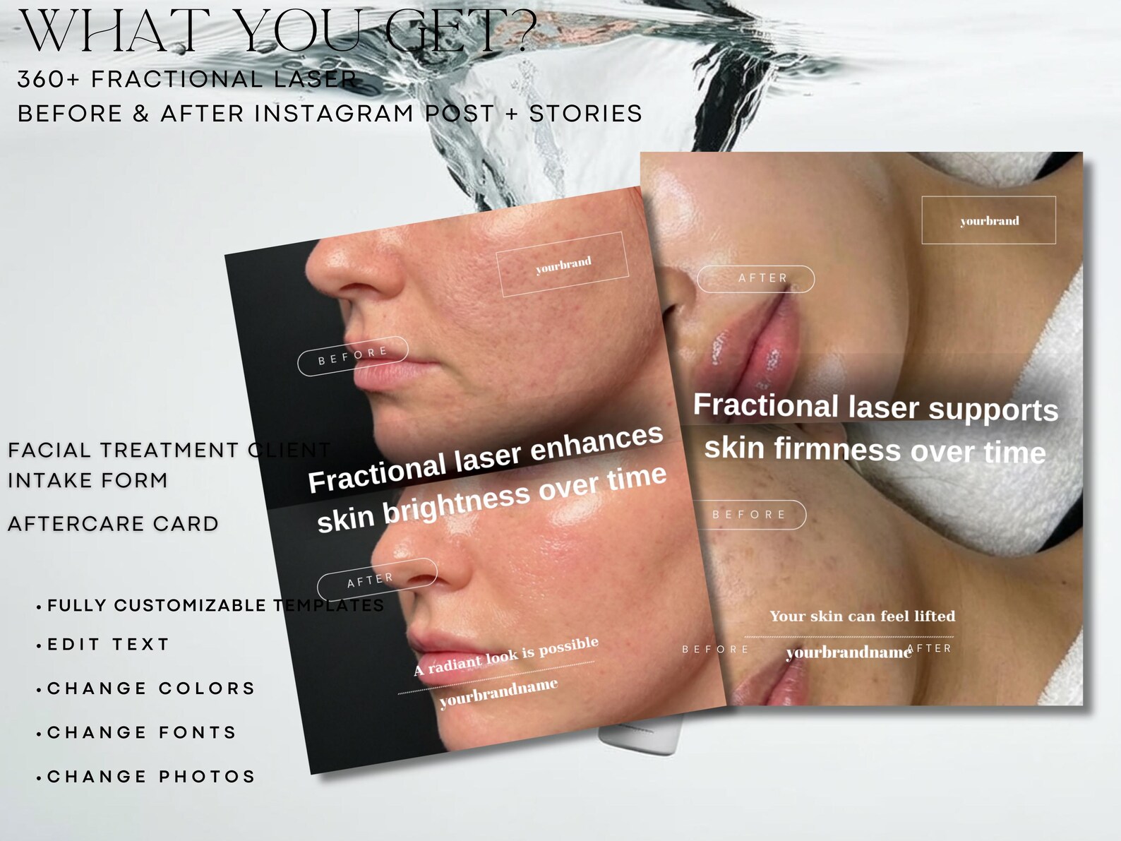 Fractional Laser Instagram Templates – Editable Canva Digital Download ...