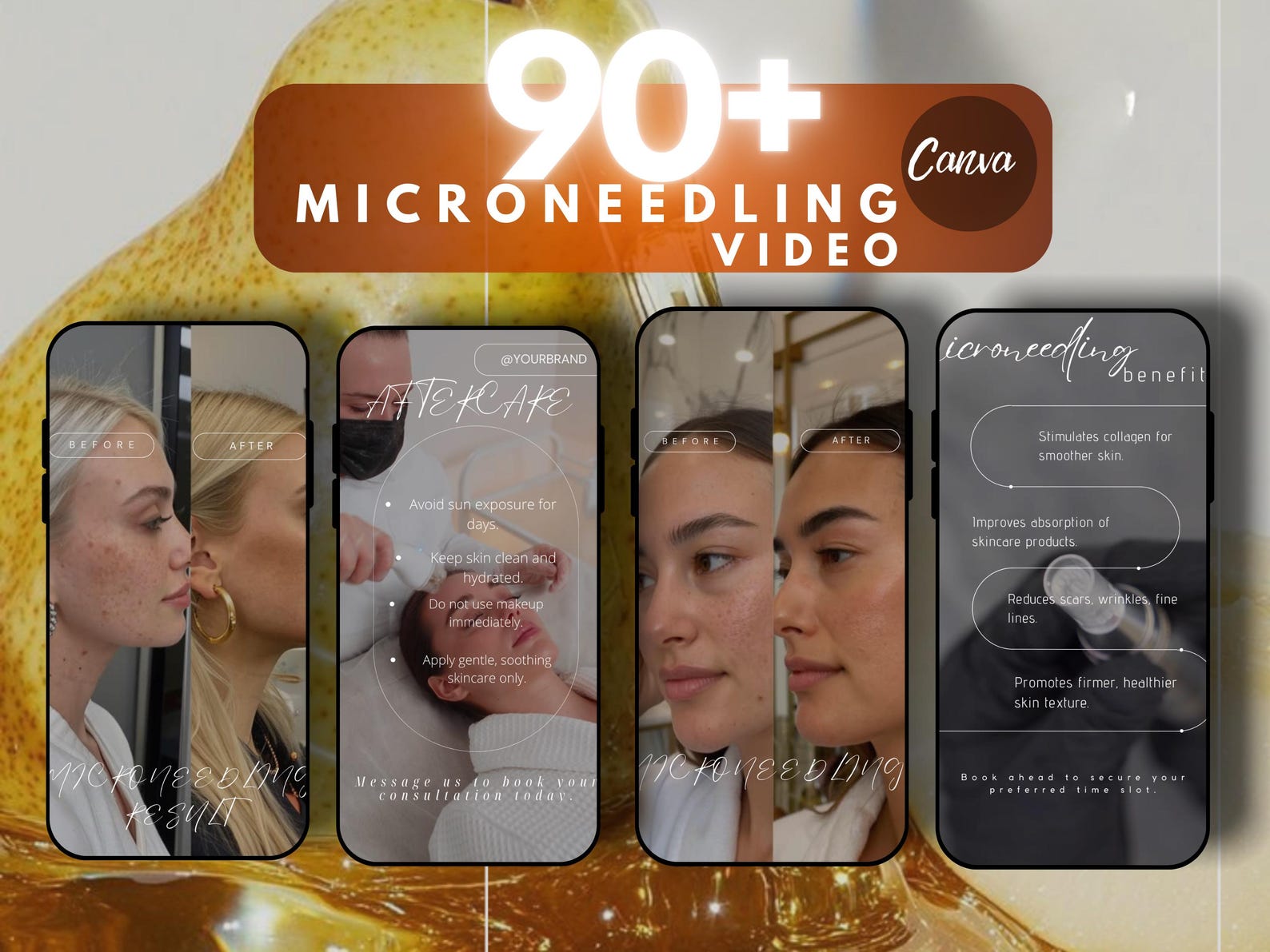 Microneedling Instagram Reels Bundle | RF & Facial Treatment Video ...