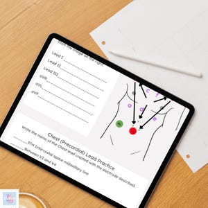 STEMI ECG Lead Guide | 12-lead EKG Mi Location Cheat Sheet - Etsy