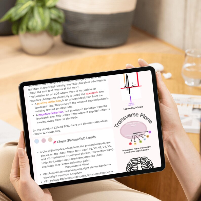 STEMI ECG Lead Guide | 12-lead EKG Mi Location Cheat Sheet - Etsy