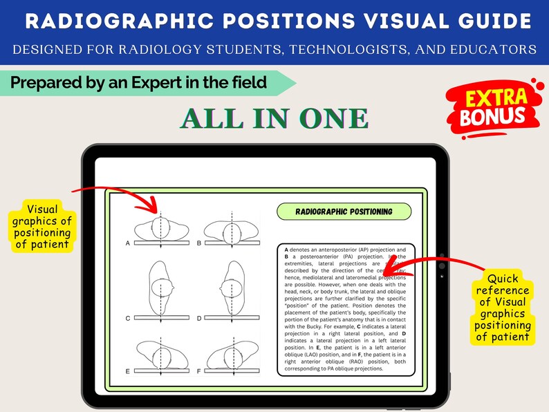 Radiography Positioning Notes Template PDF | Multi-projection Visual ...