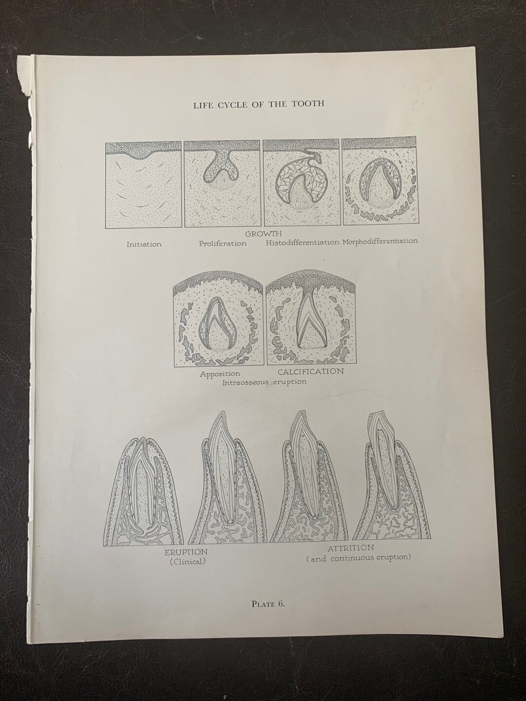 Vintage Dental Picture of the Life Cycle of the Tooth - Etsy