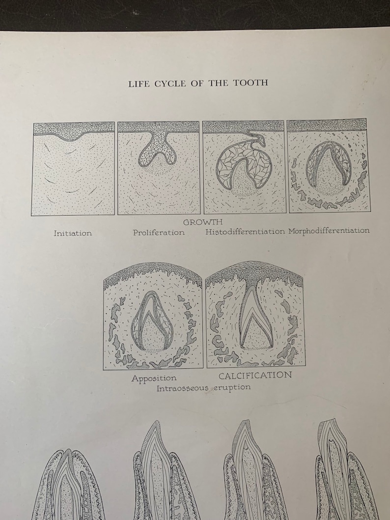 Vintage Dental Picture of The Life Cycle of the Tooth | Etsy