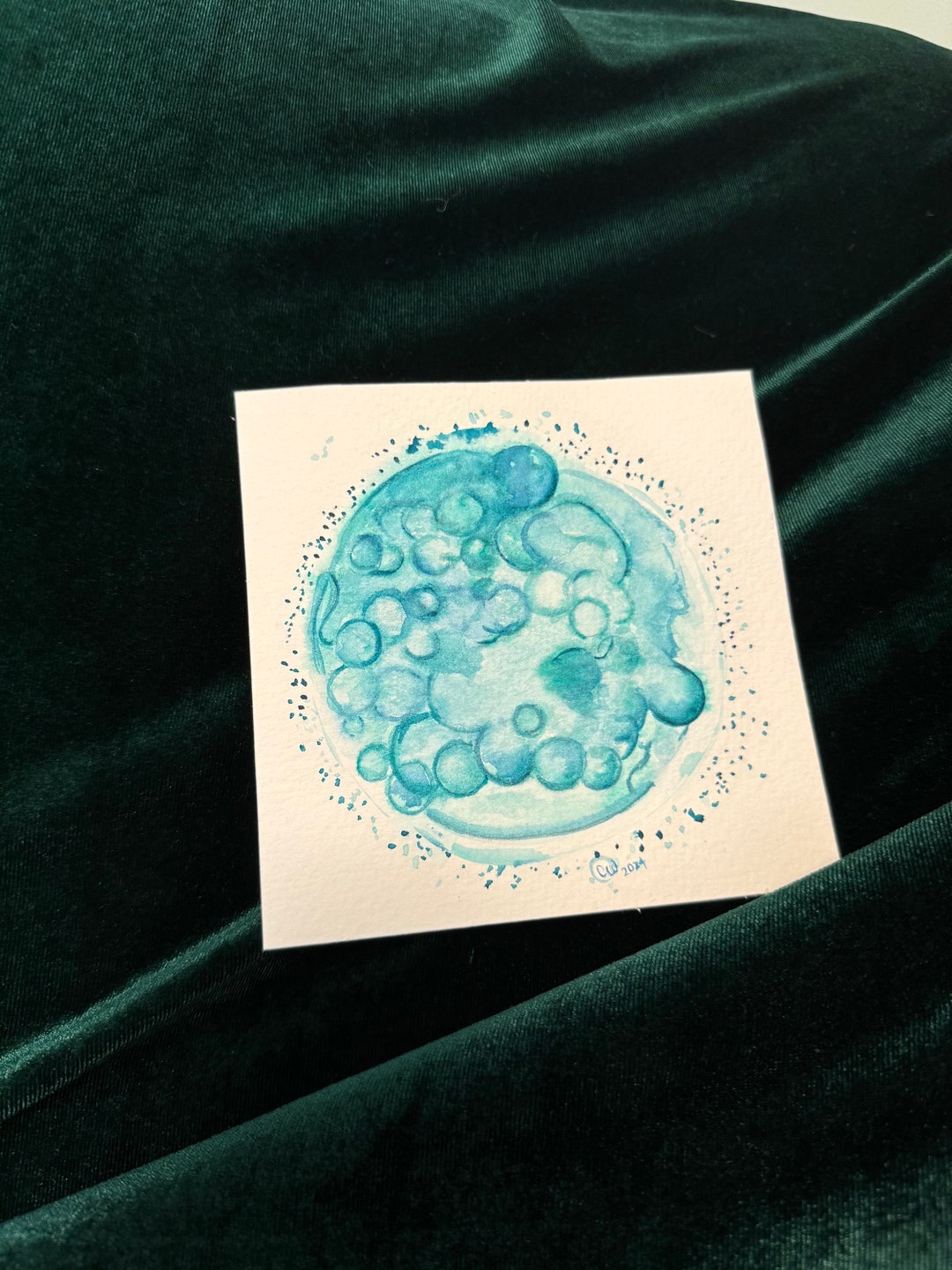 Custom IVF Embryo Watercolor Rendition From Embryo Picture ...