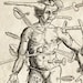 Vintage Anatomy Wounded Man Print W/ Optional Frame / High Quality ...