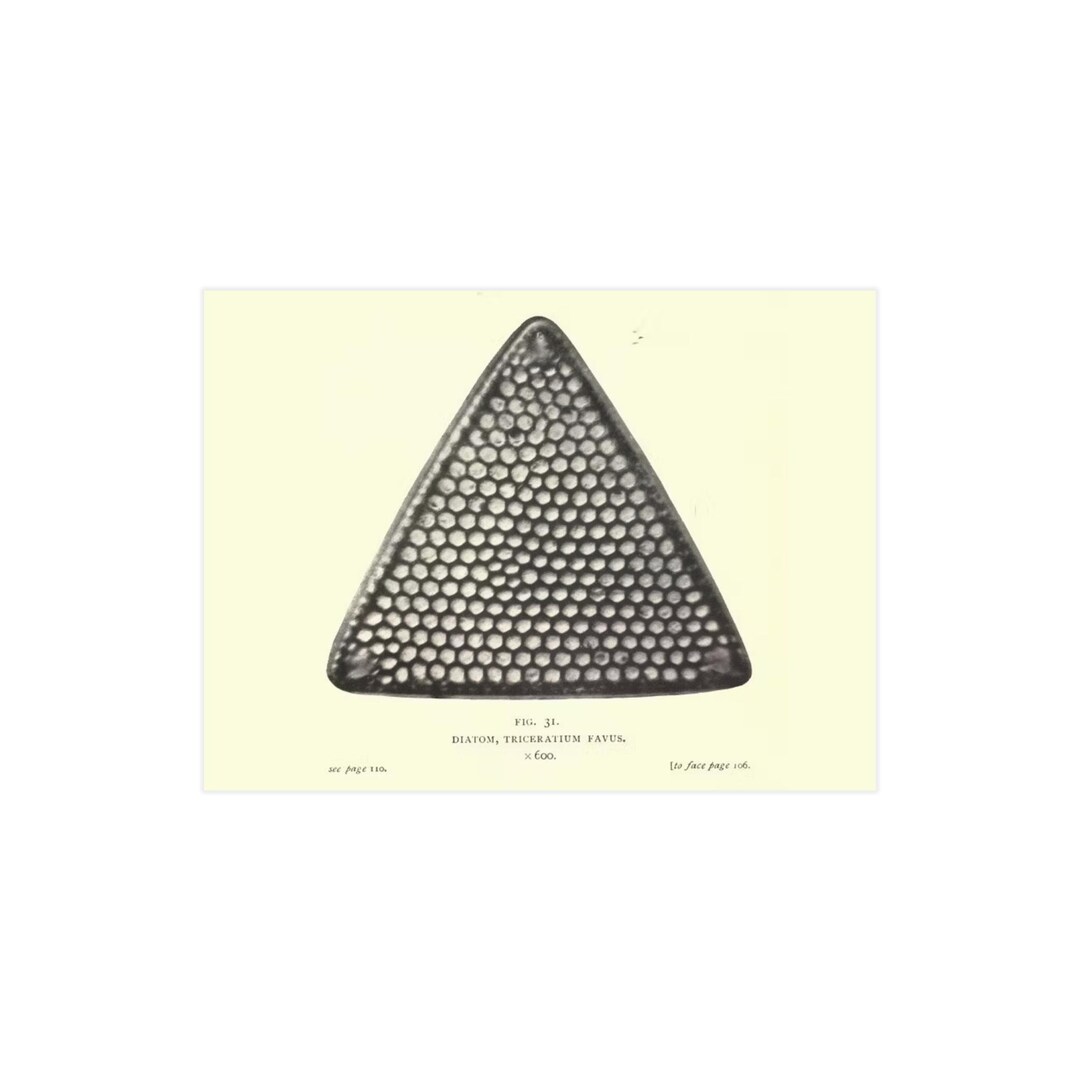 Triceratium Favus Diatom Under Microscope (1909) - Vintage Marine ...