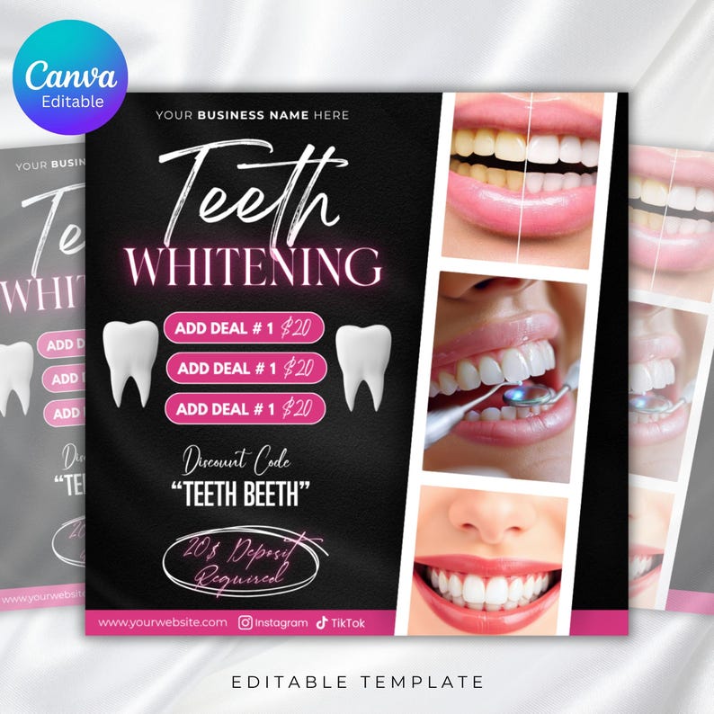Teeth Whitening Flyer, Teeth Whitening Post, Teeth Whitening Marketing ...