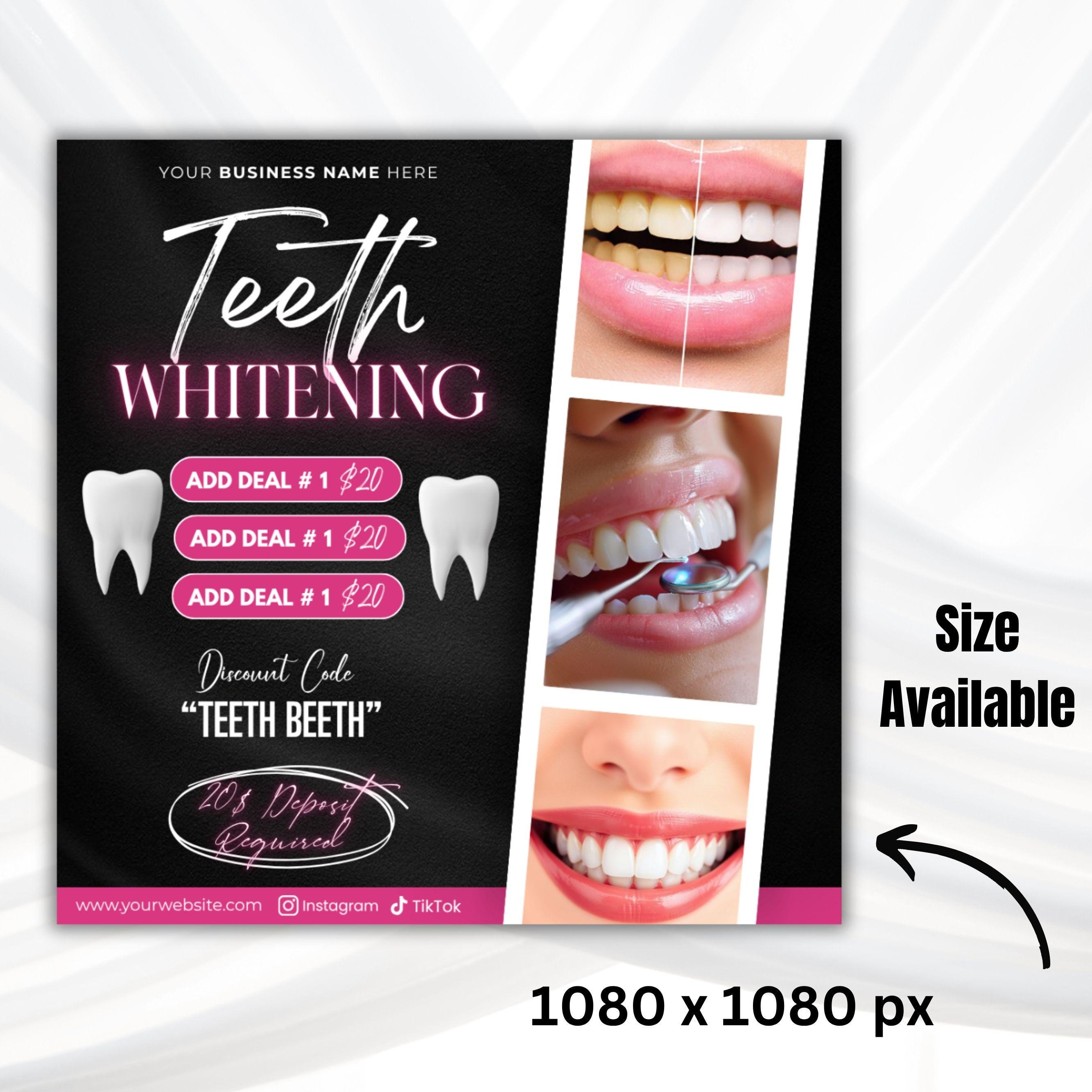 Teeth Whitening Flyer, Teeth Whitening Post, Teeth Whitening Marketing ...