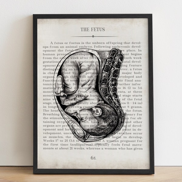 In Utero Art - Etsy