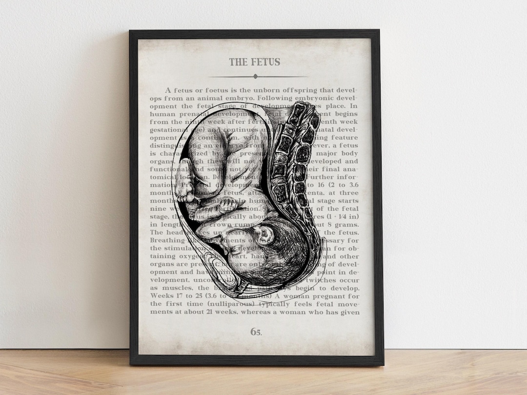Utero Fetus Art Print - OBGYN Nurse Gift - Graduation Pregnancy ...