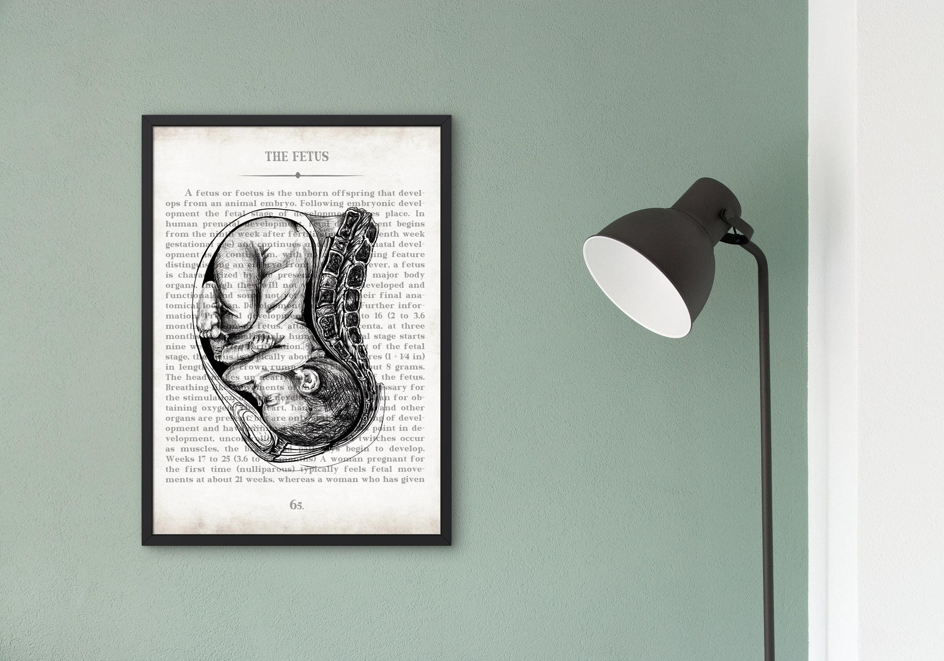 Fetus Art Print for OBGYN Office Decor Obstetrics Gynecologist Gift ...