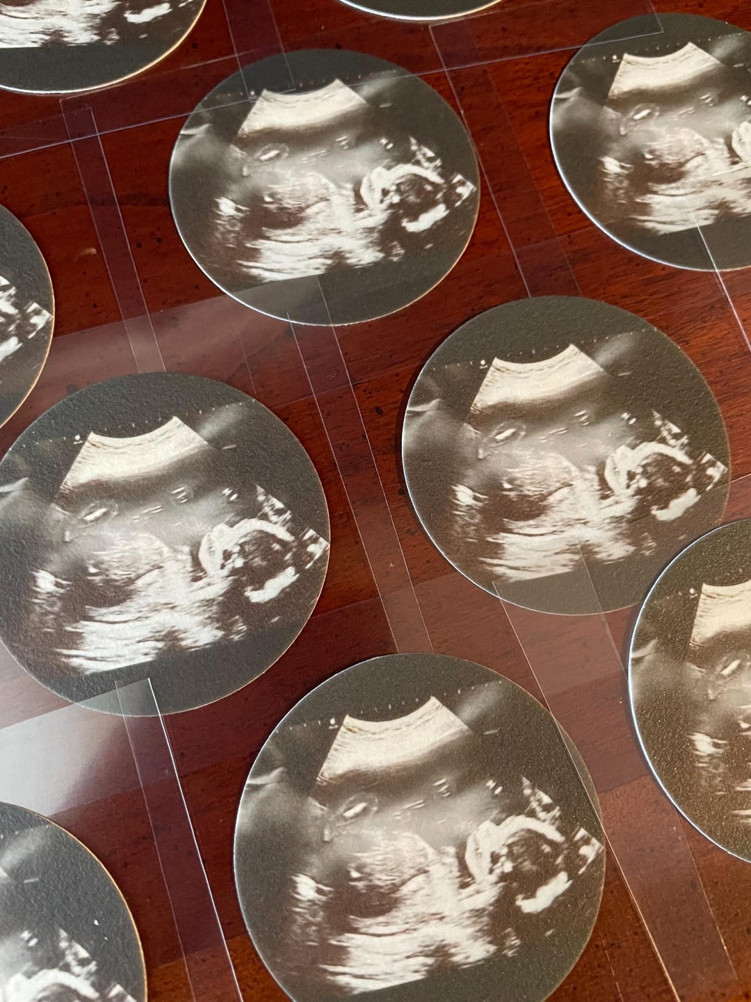 Ultrasound Edible Images | Custom Edible Images | Baby Shower Cupcake ...