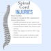 Spinal Cord Injury Visual Study Guide (C1–S5) - Etsy