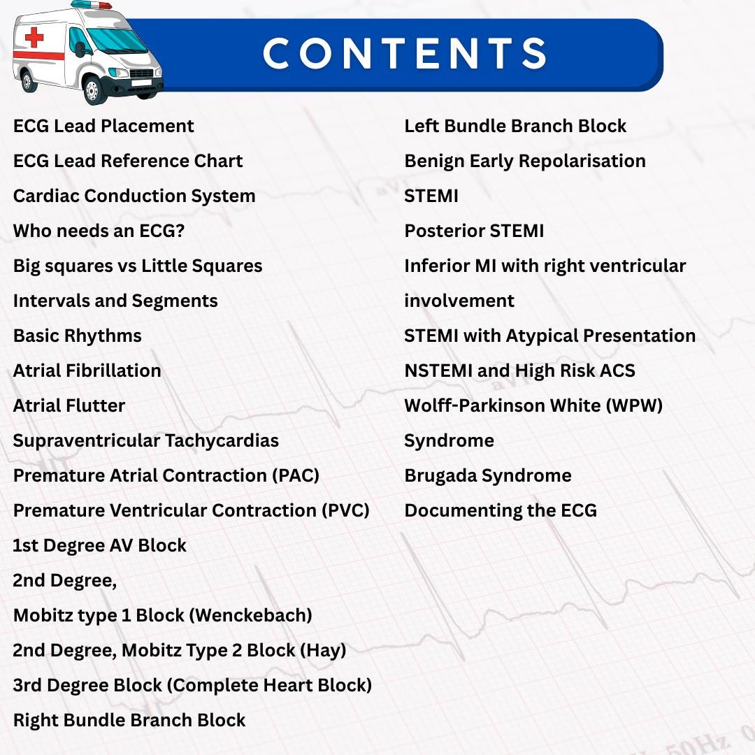 ECG Pocketbook – 12-lead ECG Interpretation for Student Paramedics - Etsy