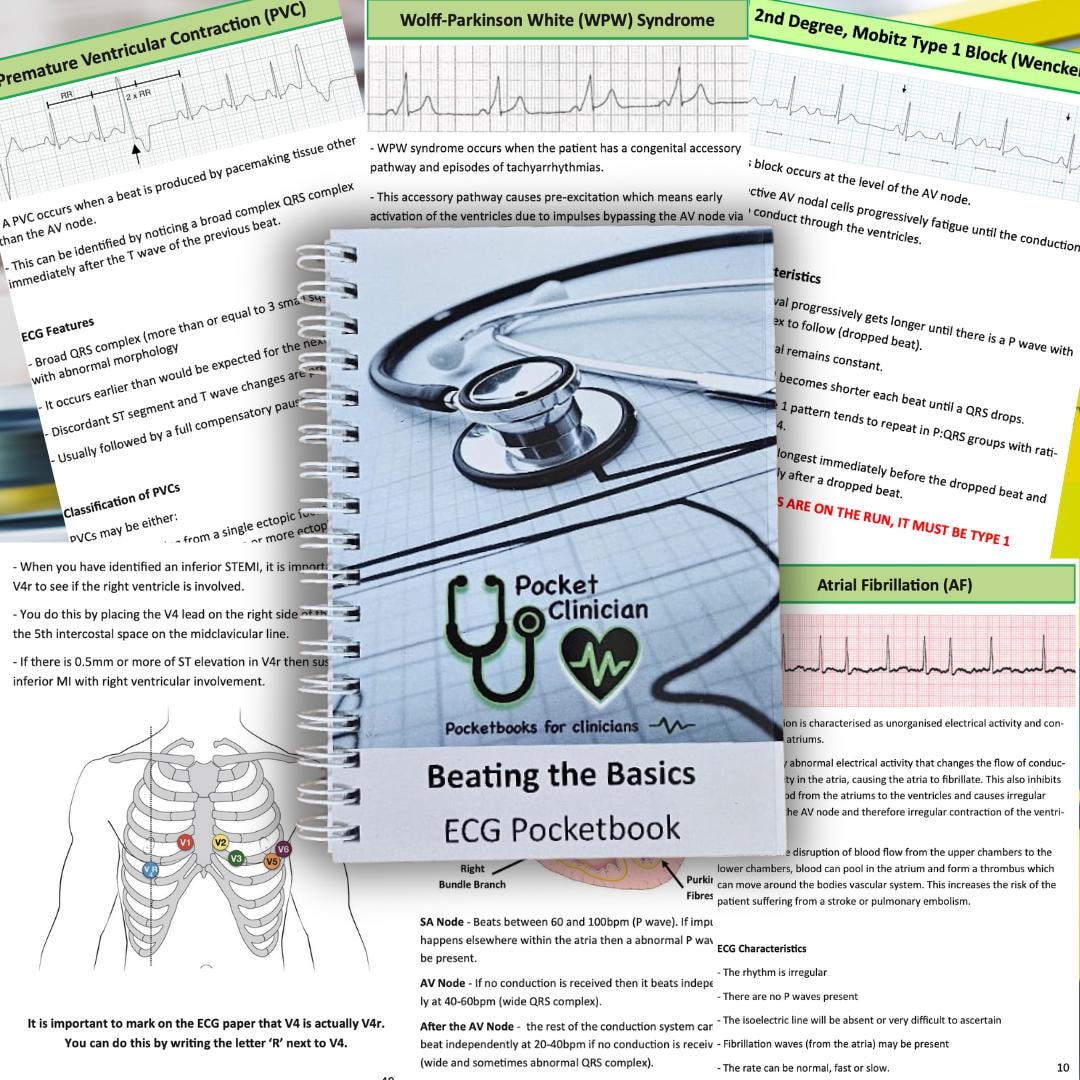 ECG Pocketbook – 12-lead ECG Interpretation for Student Paramedics - Etsy