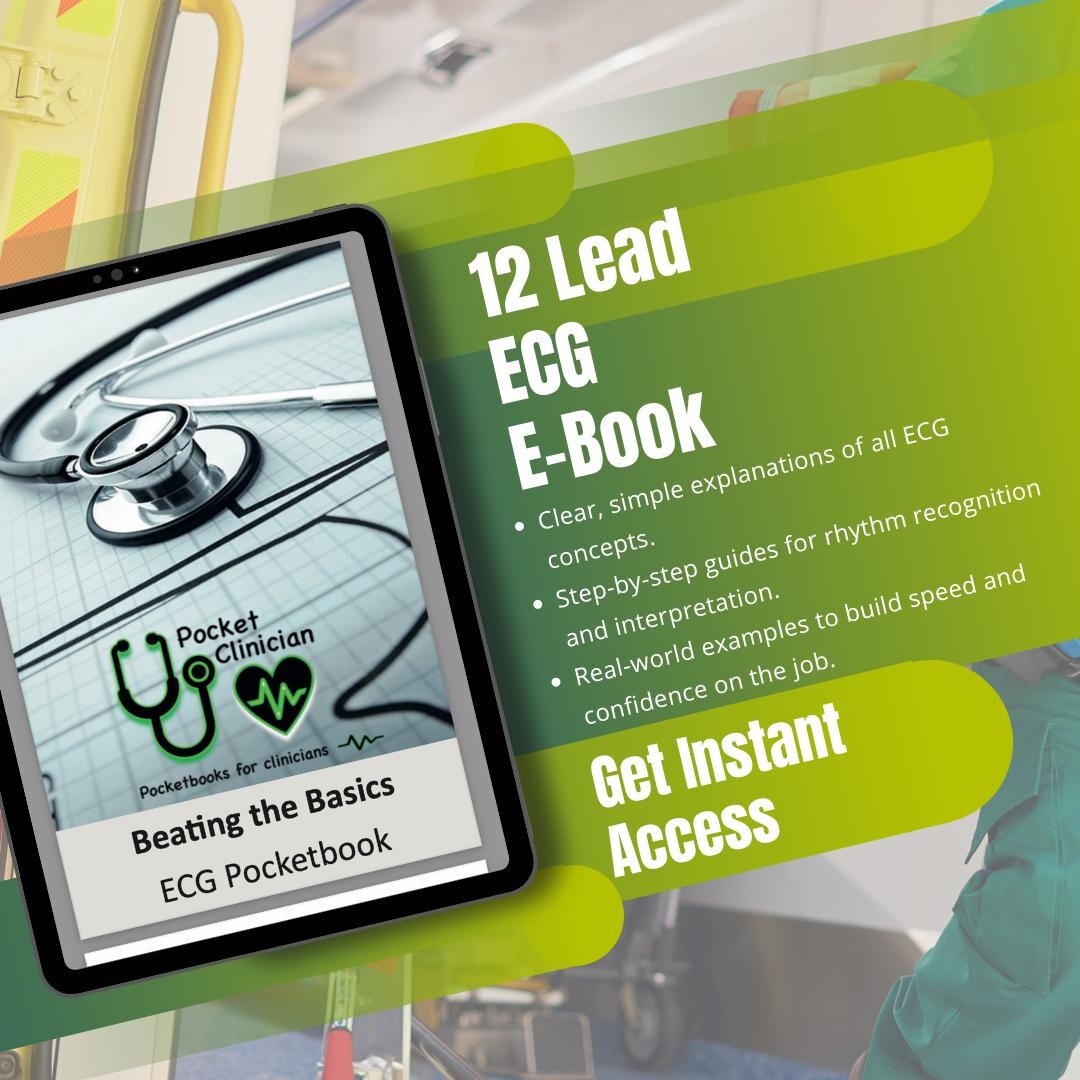 ECG: Beating the Basics E-book - Etsy