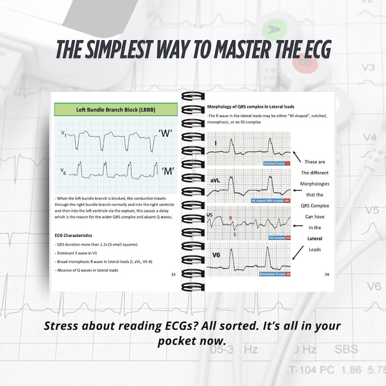 ECG Pocketbook – 12-lead ECG Interpretation for Student Paramedics - Etsy