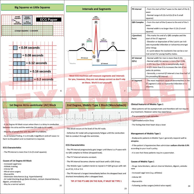 ECG Pocketbook – 12-lead ECG Interpretation for Student Paramedics - Etsy