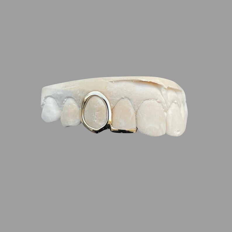 Custom Open-face Window Tip Cap Grillz – Gold or Sterling Silver – Any ...