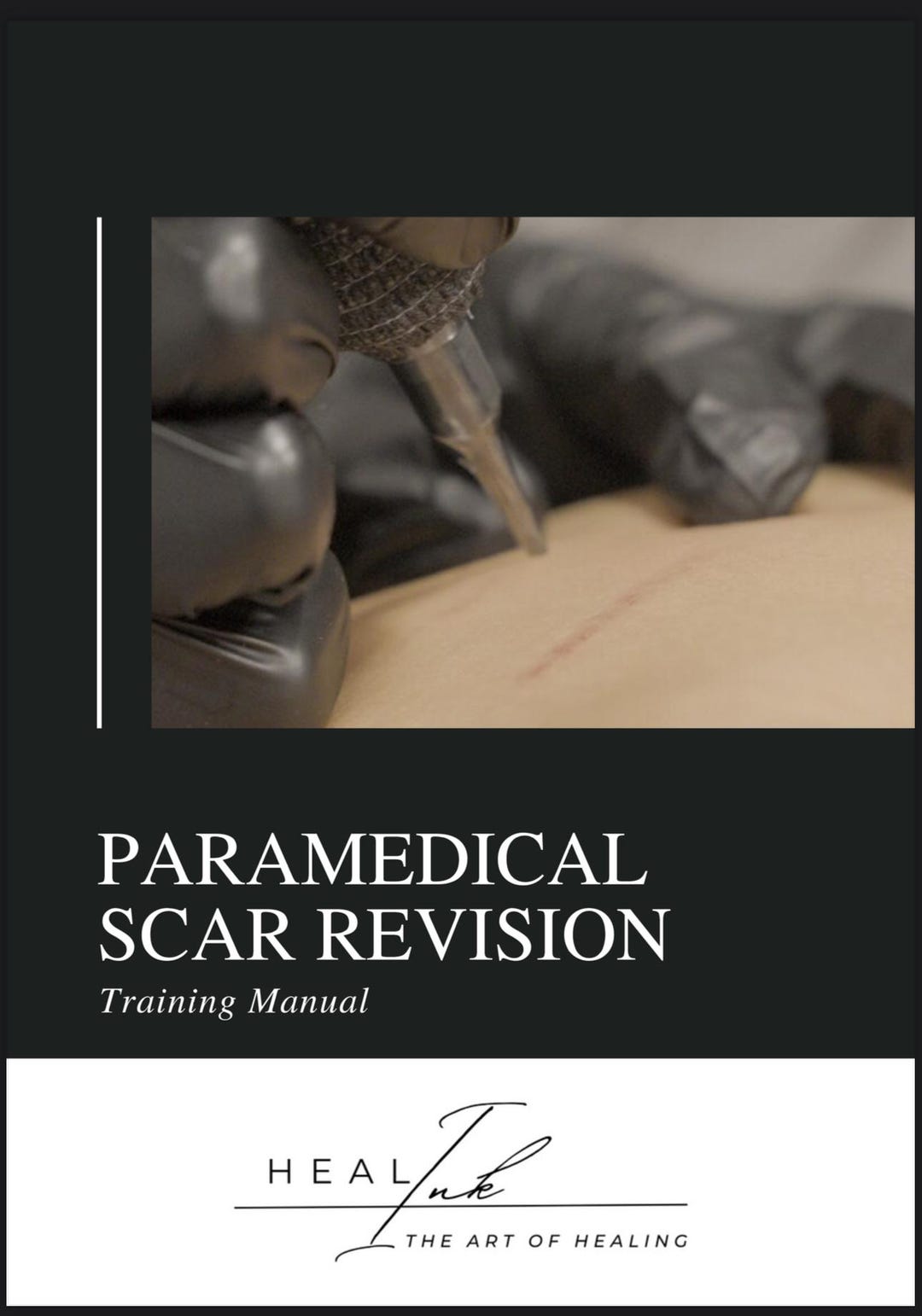 Scar Revision Training Manual & Videos! *incl. Certificate* Scars and ...