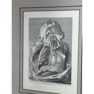 1777 Anatomy,arteries of the Thorax, Custom Beck Frame D. F Cameron 3/ ...