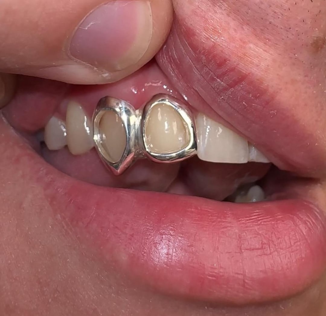 Double Open Face Window, Vampire Fang Cap– Custom Made Gold & Silver ...