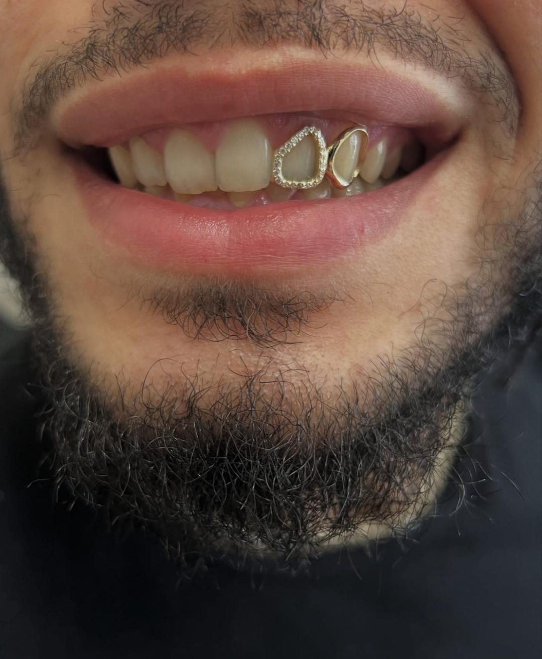 Iced Out Diamond Open Face Window and Plain Cap– Custom Made Gold ...