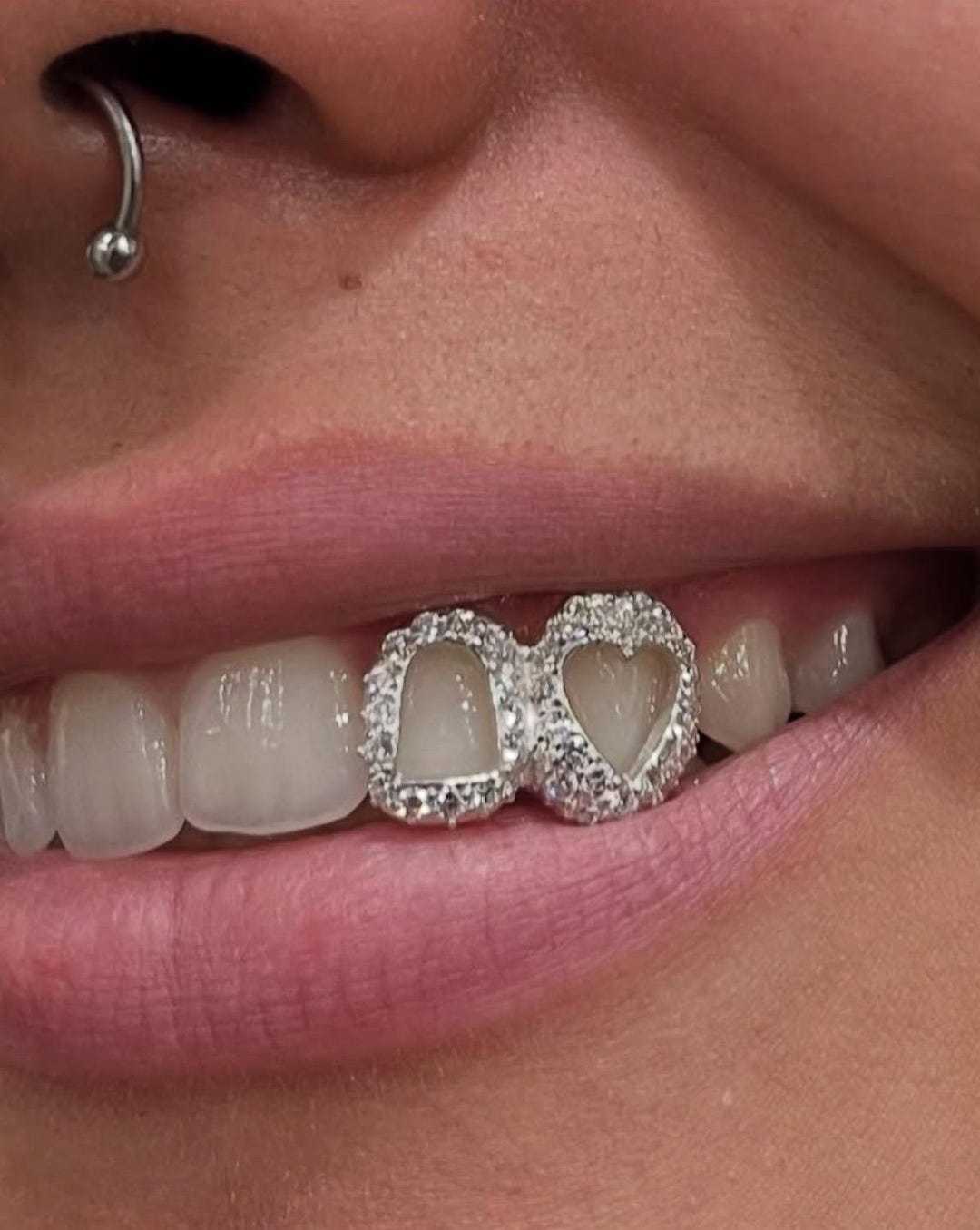 Iced Out Diamond Heart Window Grillz– Custom Made Gold & Silver Grillz ...