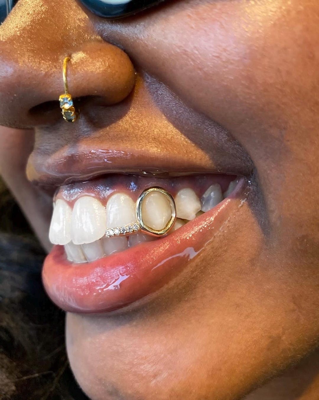 Open Face Window Diamond Inlay Cap– Custom Made Gold & Silver Grillz ...