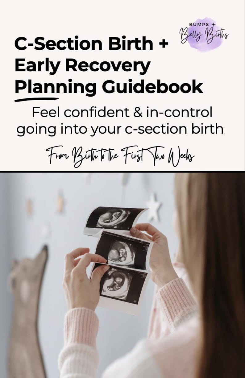 C-section Birth + Recovery Planning Guide | Feel Confident and In ...