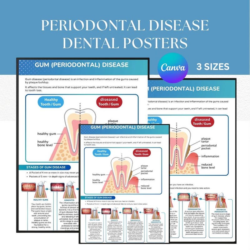 Dental Education Wall Art - Etsy
