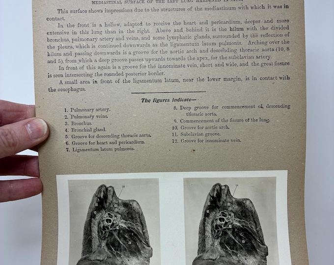 1905 Human Lung Dissection Medical Stereoview Card Thorax - Lungs ...