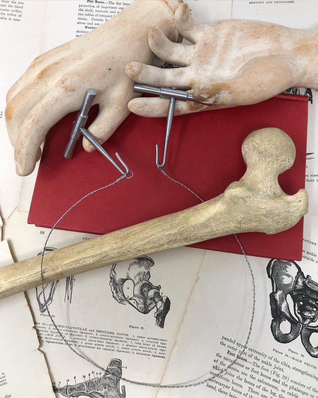 Gigli Amputation Bone Saw Wire Medical Tool - Set of 3 Parts - Etsy