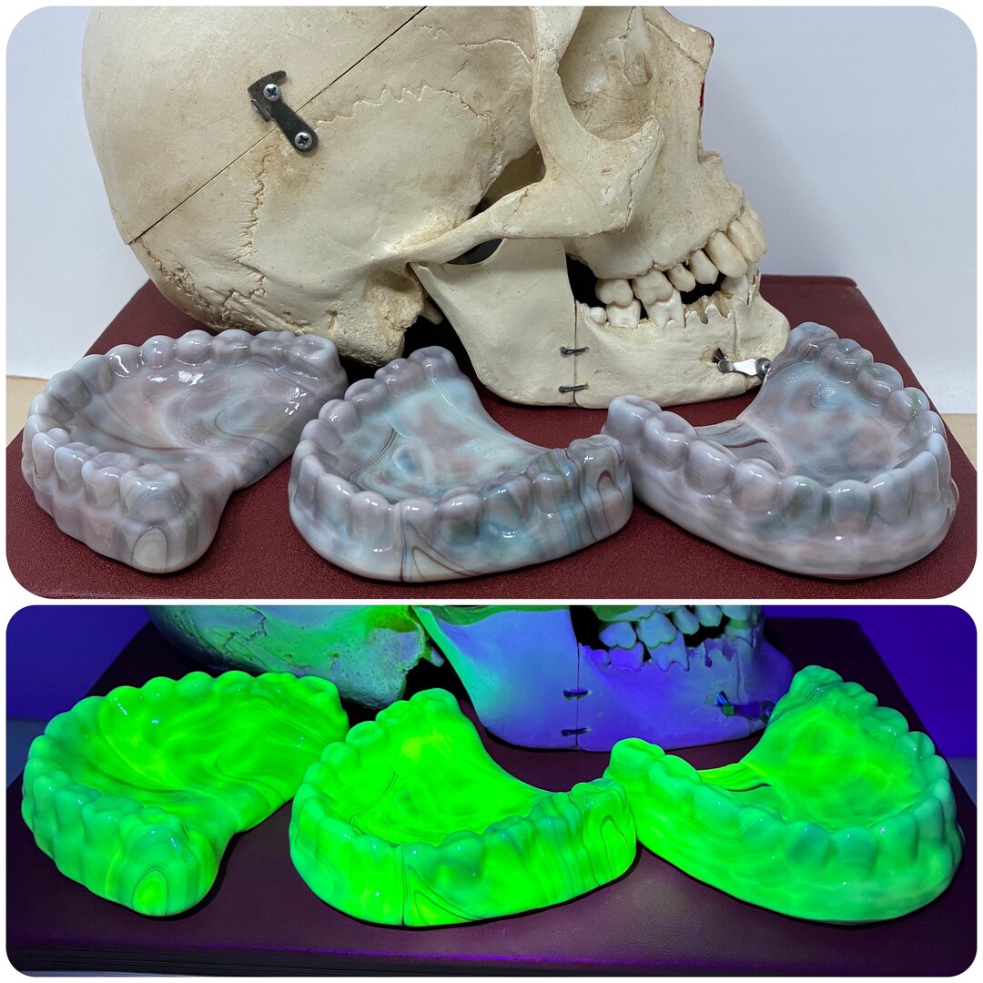 PICK ONE! Glowing Uranium Milky Slag Glass Human Teeth - 395 & 365 UV ...