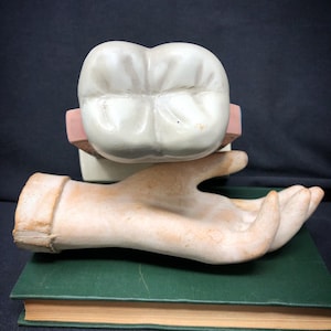 Big Tooth Model Advertising Dental Decay Molar - Dentist Office ...