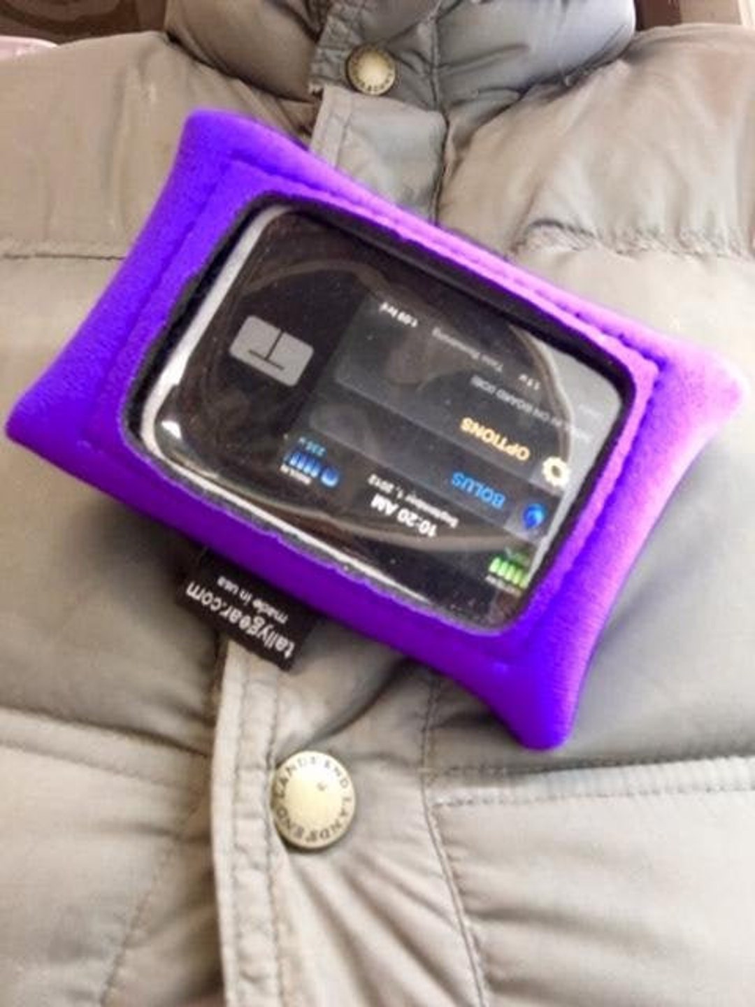 Medtronic, Ilet, Tslim, Insulin Pump, Case, Belt Clip, Clear Vinyl ...