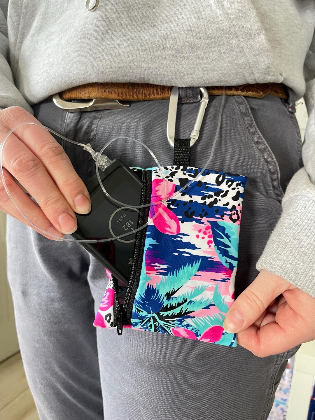 Ilet, Tslim, Tslim Mobi, Medtronic Insulin Pump, Dexcom Case-hibiscus ...