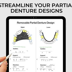 RPD Design Template: Printable Guide for Dentists & Students (PDF) - Etsy